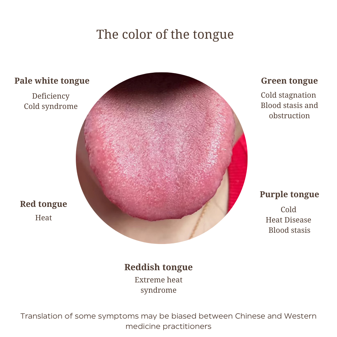 Chinese Tongue Diagnosis: How to Determine Health Through Tongue Color ...